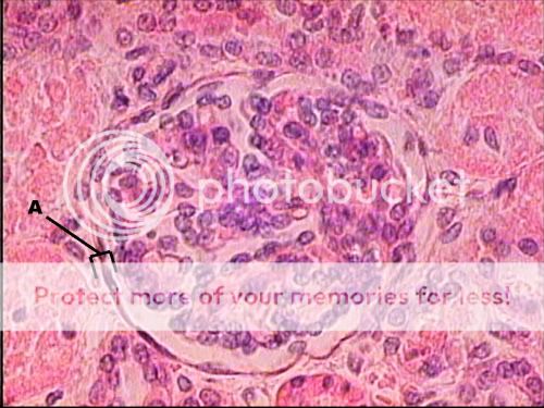 Bowmans Capsule Slide